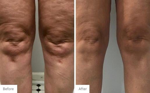Firm Body Contour Cream | Tightening Skin Cream | Anti-Aging Solutions